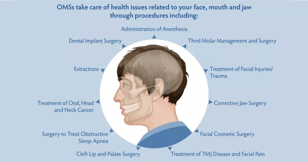 Why Visit An OMS Pottstown Oral Surgery Blog